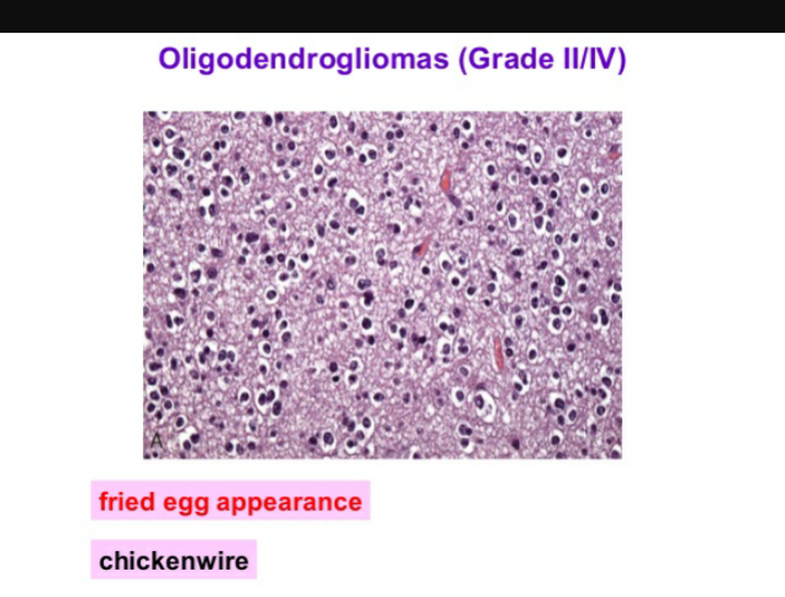 Building A Unified Test Automation Framework For Legacy And Modern Sys ...